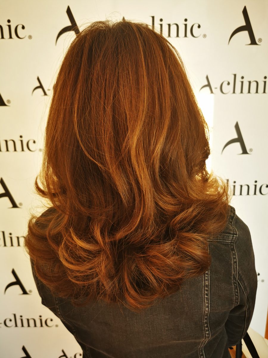 Blond, bruin, rood of donker haar verven bij A-clinic | A-clinic ...